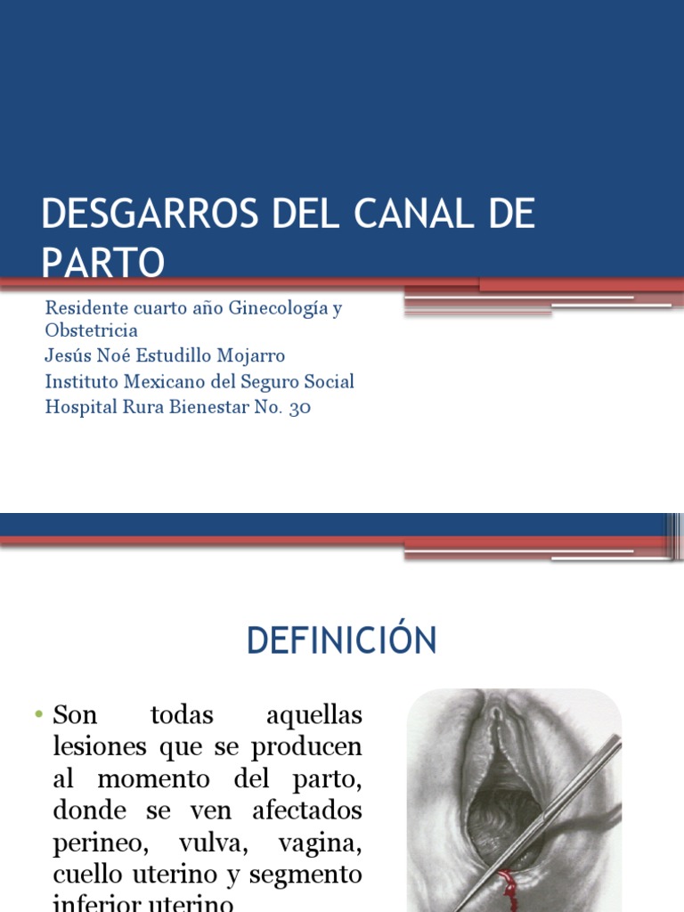 Desgarros Del Canal de Parto | PDF | Parto | Vagina