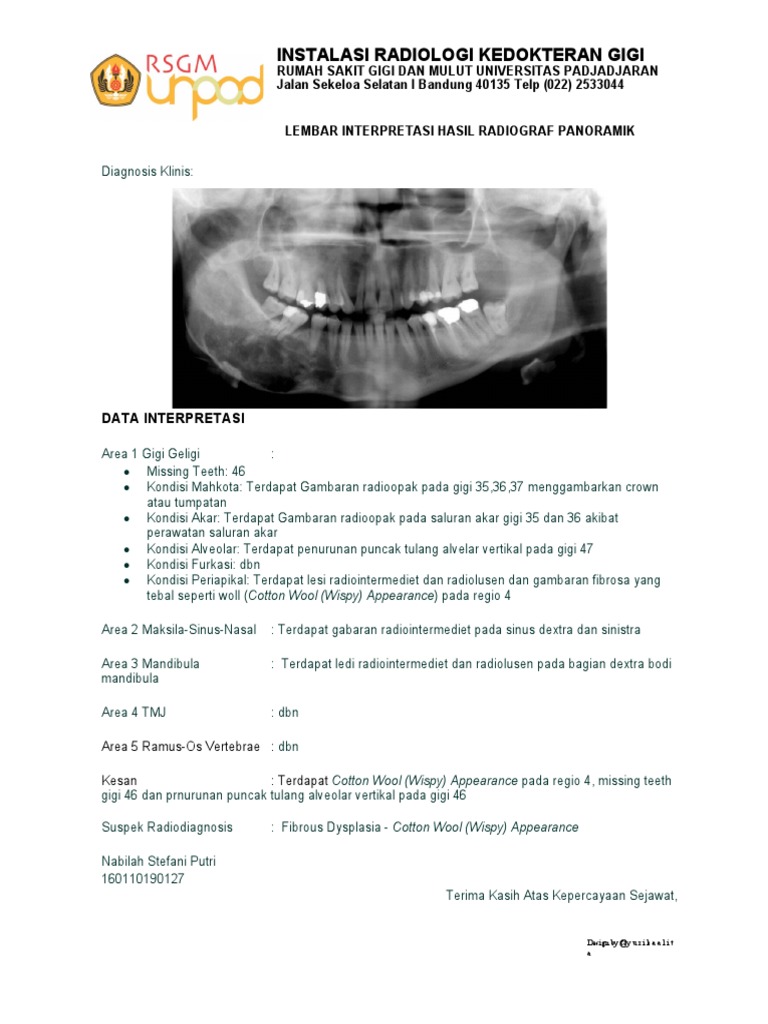Interpretasi Radiografi Gigi | PDF