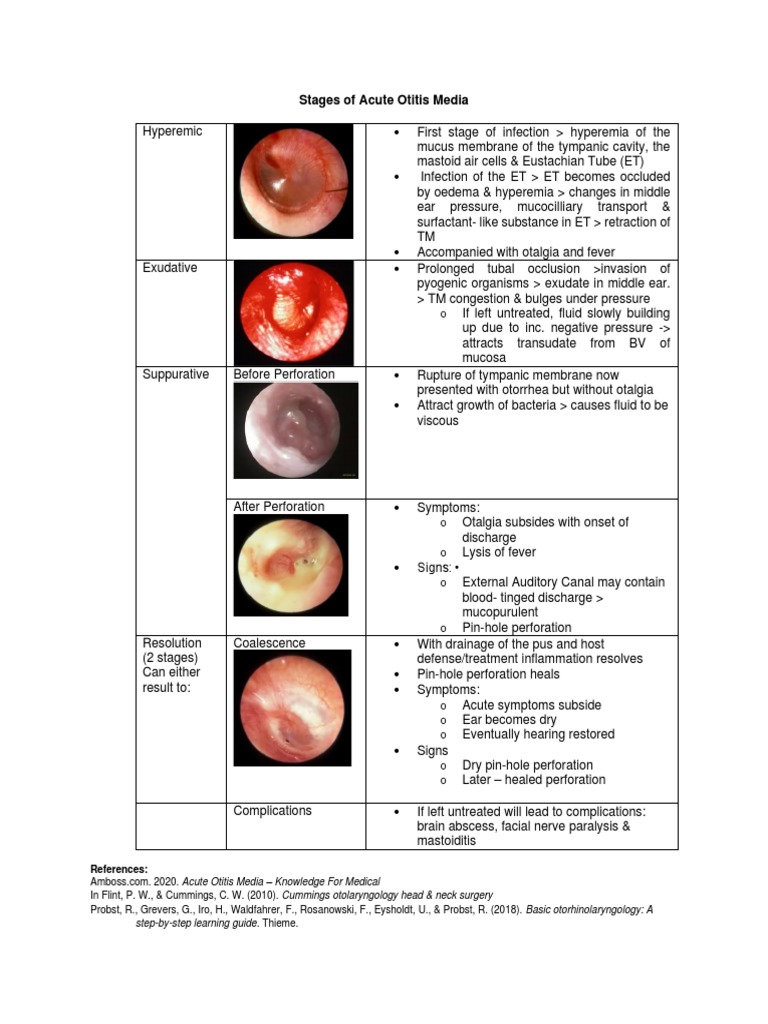 Stages of Acute Otitis Media | PDF | Surgical Specialties | Health Sciences