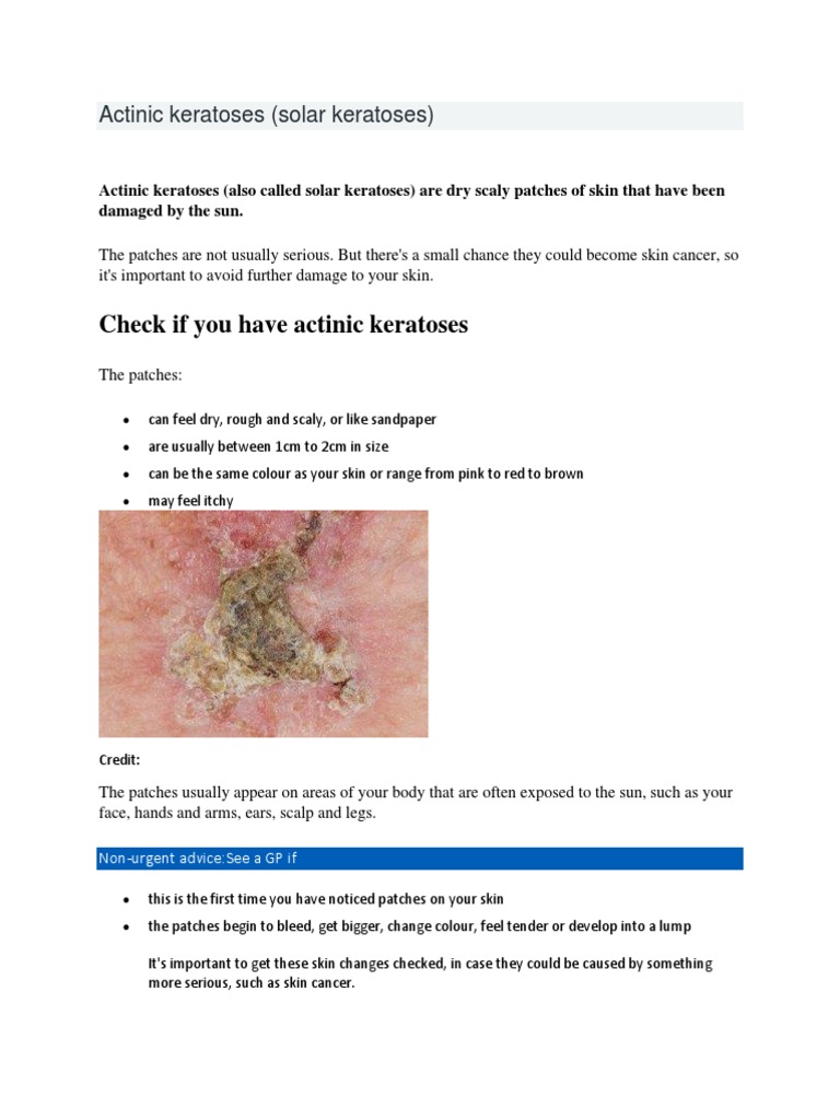 Actinic Keratoses | PDF | Skin Cancer | Sunscreen