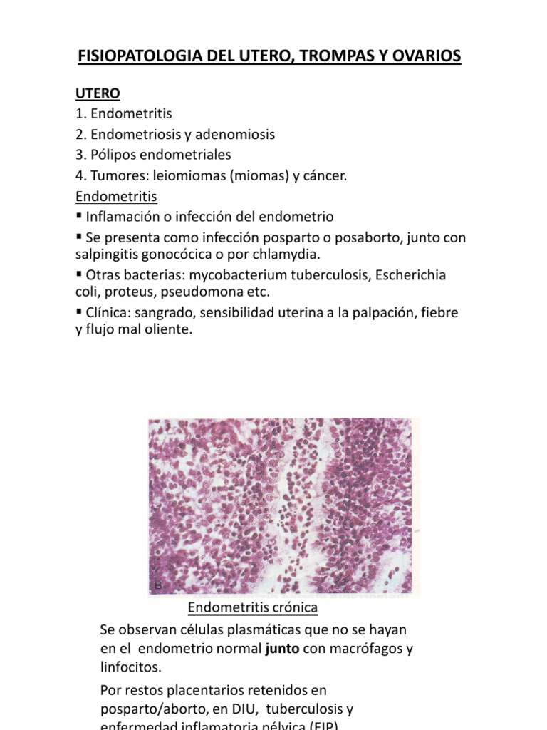 Fisiopatologia Del Utero Ovario Y Trompas Pdf Ovario Cáncer De