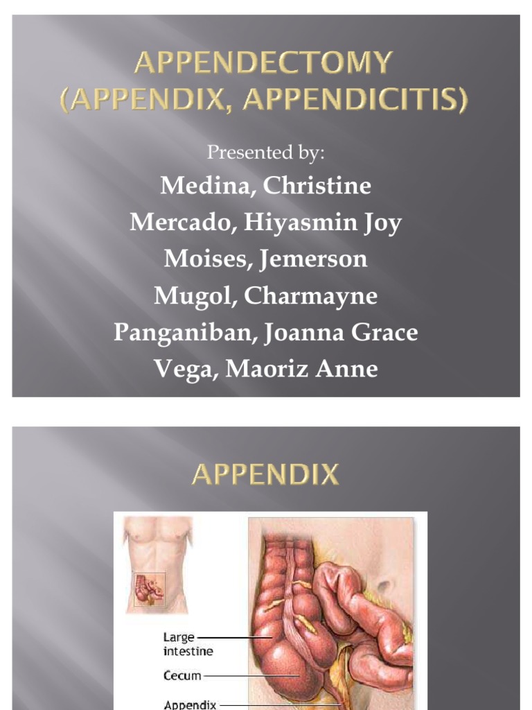 Appendectomy | PDF | Nausea | Diseases And Disorders