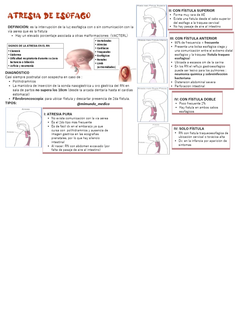 Atresia de Esofago | PDF | Anatomía | Órgano (anatomía)