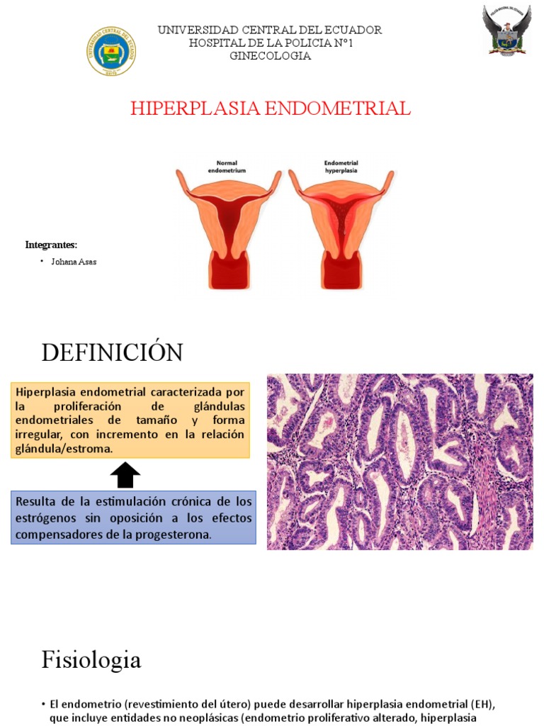 Hiperplasia Endometrial: Definición y Tratamiento | PDF ...
