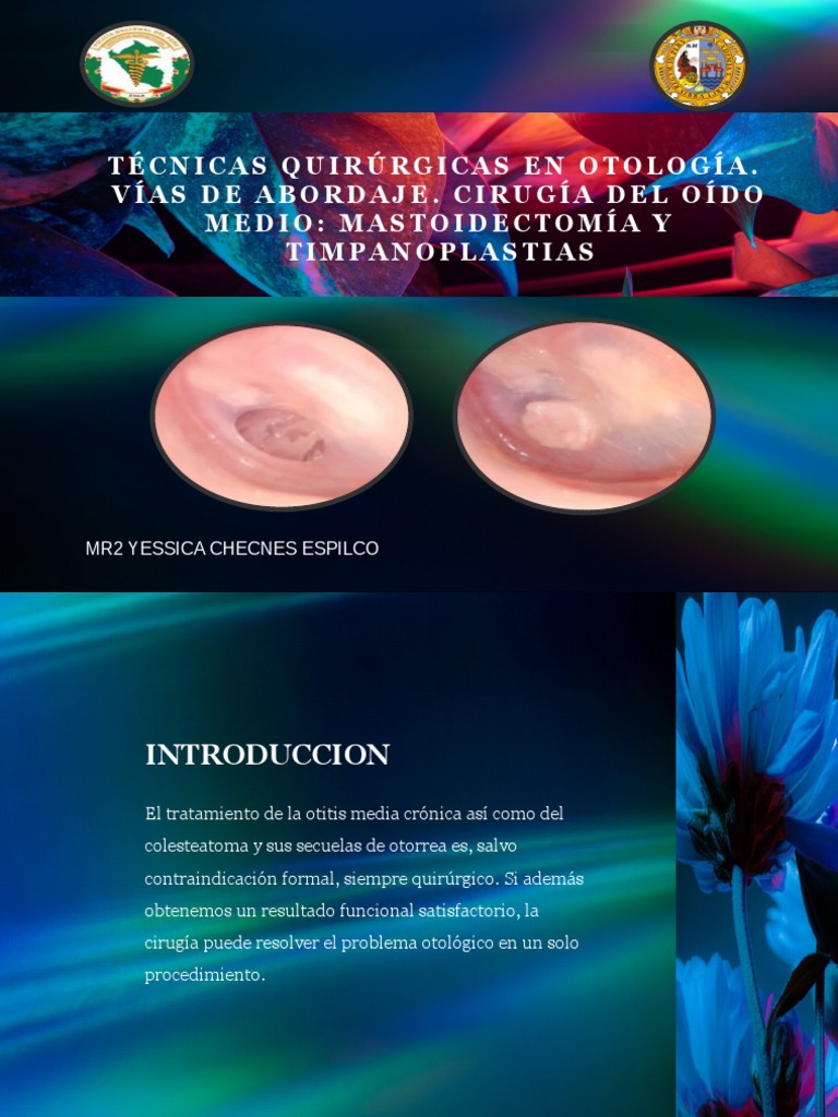Timpanoplastia - Mastoidectomia | PDF | Oído | Medicina CLINICA