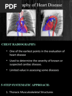 The Radiology Assistant - Chest X-Ray - Heart Failure | PDF | Heart ...