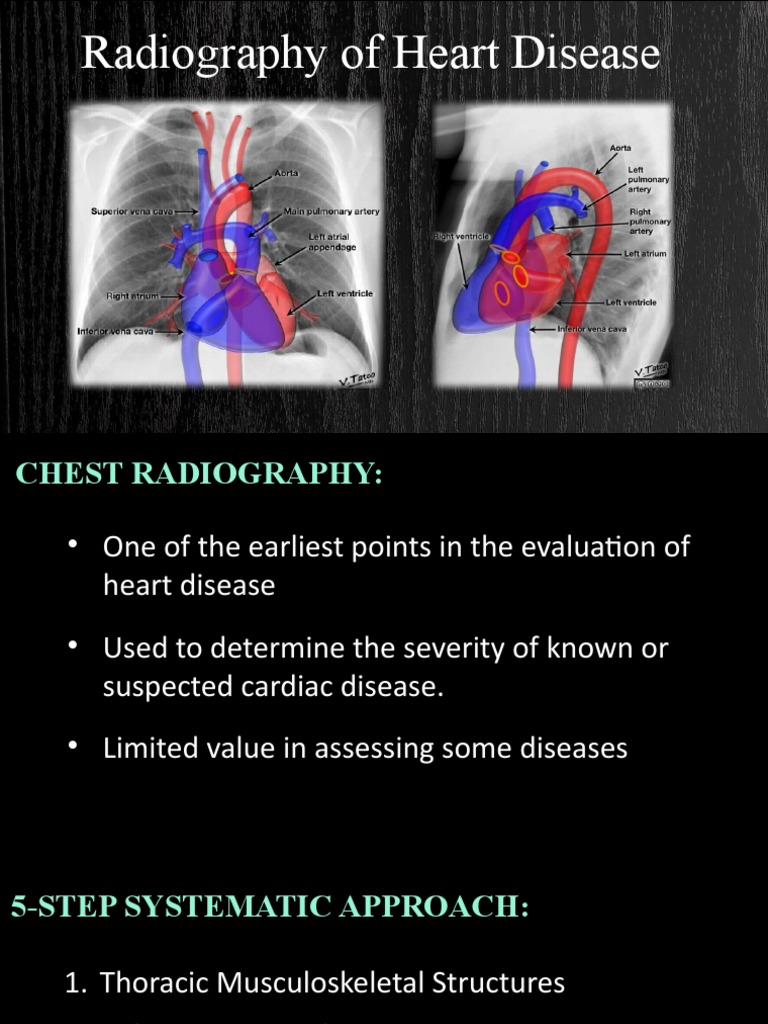 Cardiovascular Pathology FINAL | PDF | Heart | Lung