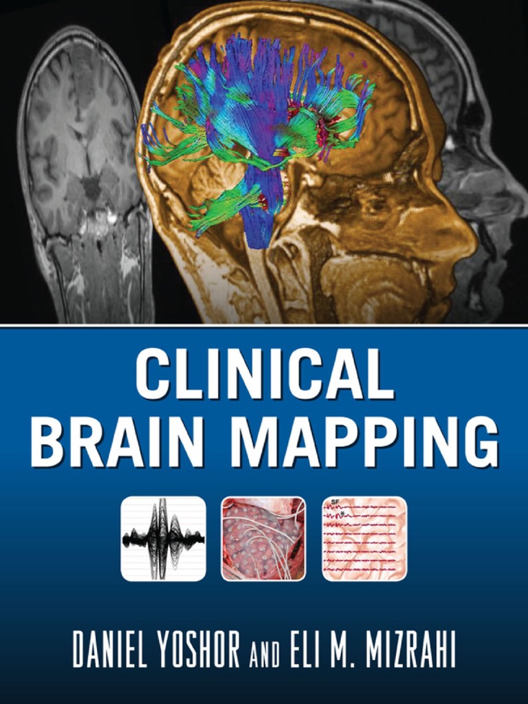 Vdoc - Pub Clinical Brain Mapping | PDF | Frontal Lobe | Parietal Lobe