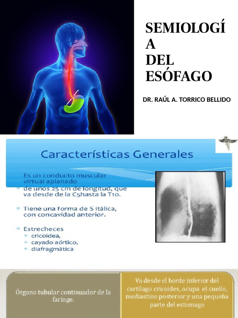 Semiologia Del Esófago | PDF