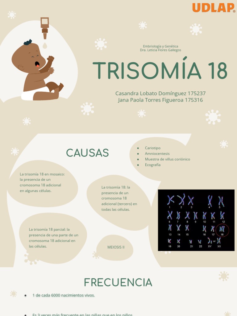 Trisomía 18 | PDF | Especialidades Medicas | Genética