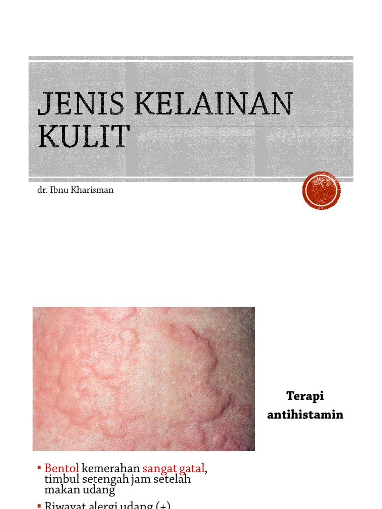 JENIS Kelainan Kulit | PDF