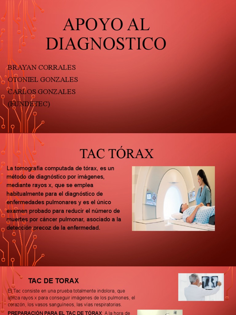 EXPOSICION APOYO AL DIAGNOSTICO BRAYAN | PDF | Ct Scan | Cáncer de pulmón