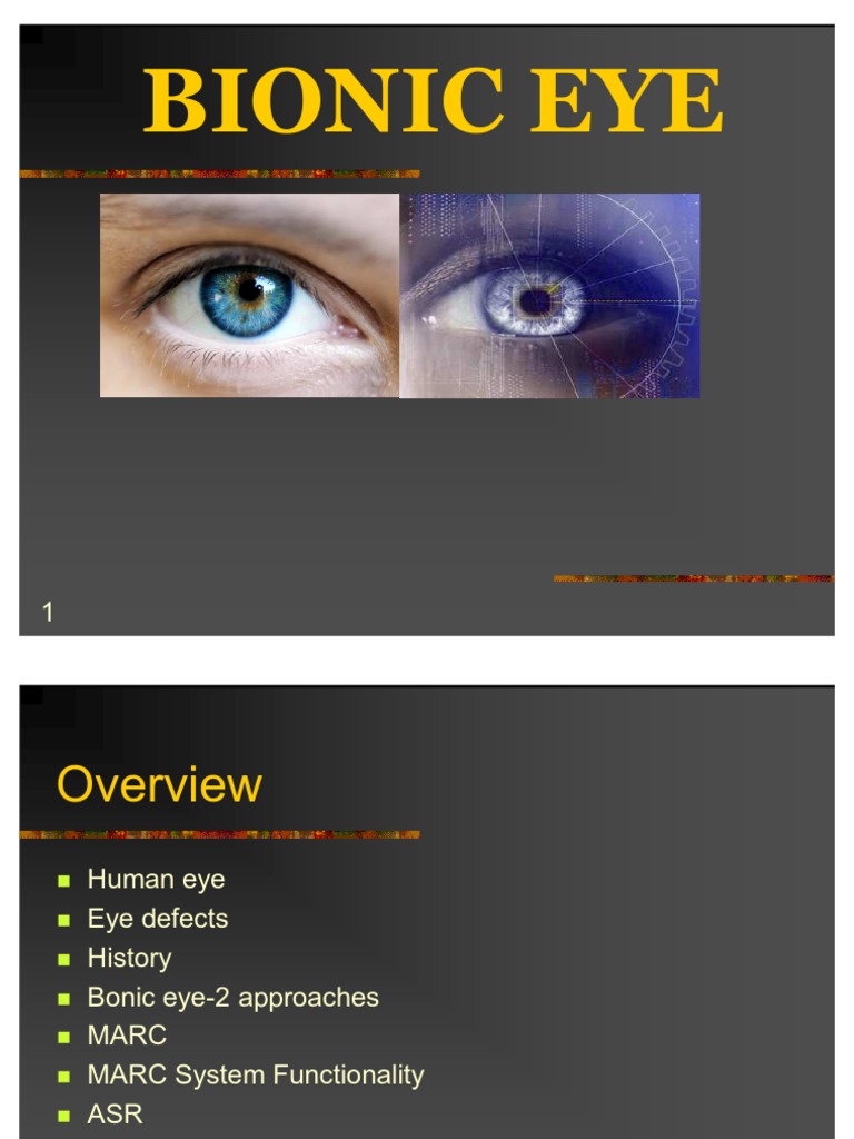 Bionic Eye and Retina Implant Overview | PDF | Retina | Electromagnetism