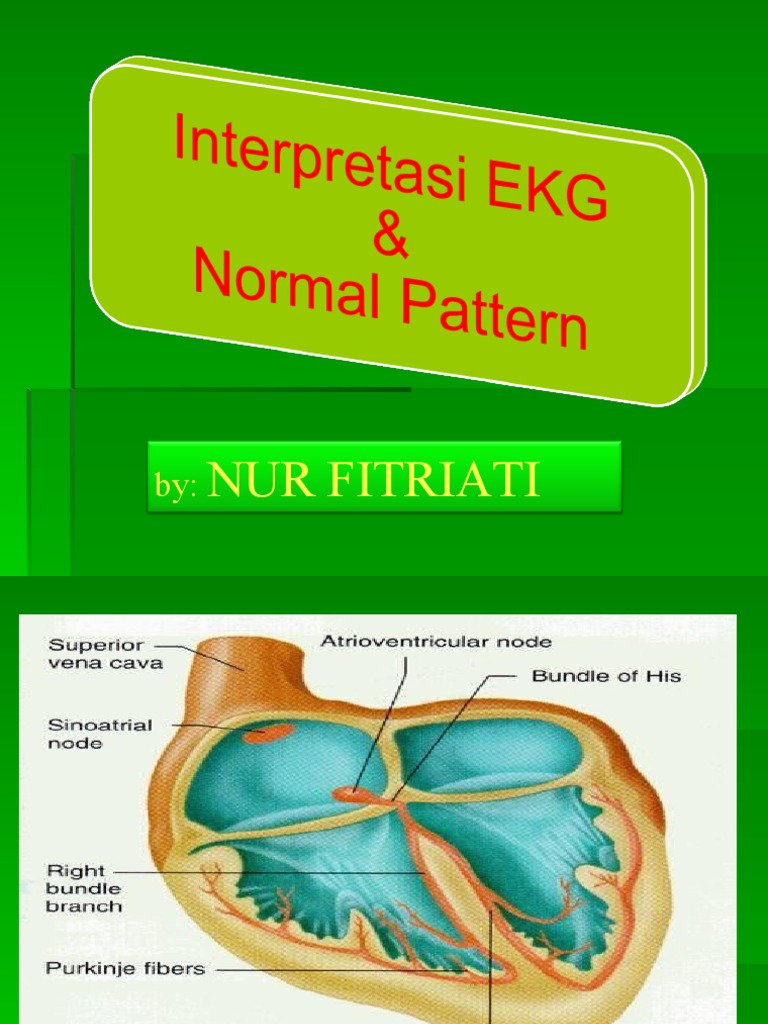 Interpretasi Ekg - PPT | PDF