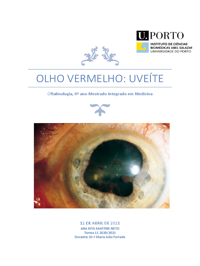 Uveíte: Causas e Classificações | PDF | Olho humano | Doenças e distúrbios