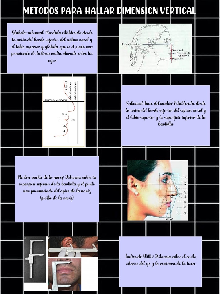 Metodos para Hallar Relacion Centrica y Dimension Vertical | PDF