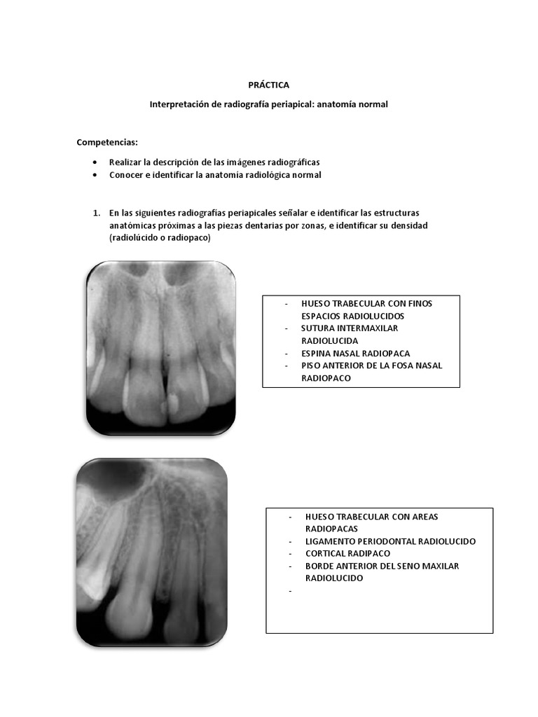 Interpretacion de RX Periapical | PDF | Hueso | Diente
