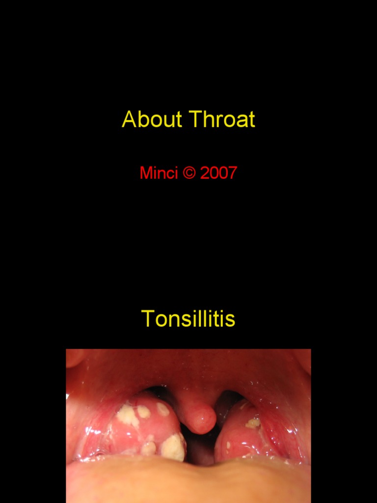 Throat Powerpoint | PDF | Medical Specialties | Diseases And Disorders