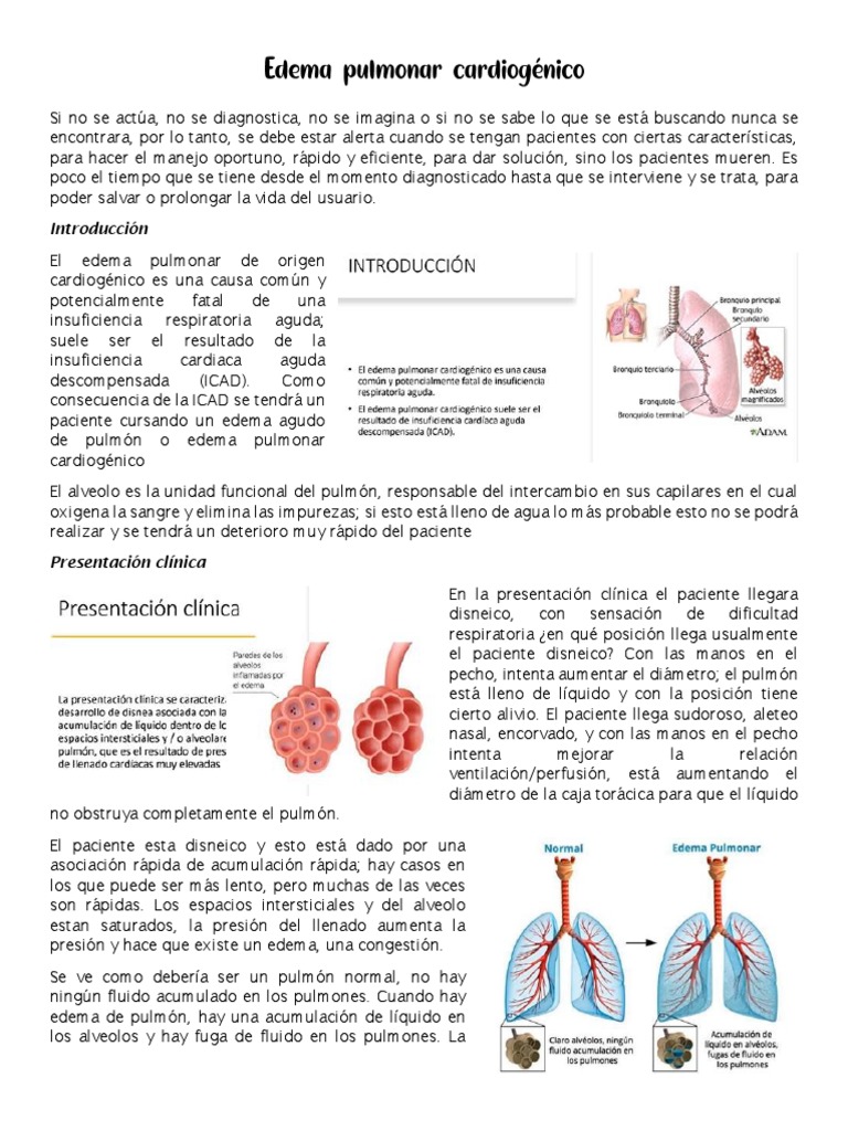 Edema Pulmonar Cardiogénico | PDF | Insuficiencia cardíaca | Hipertensión