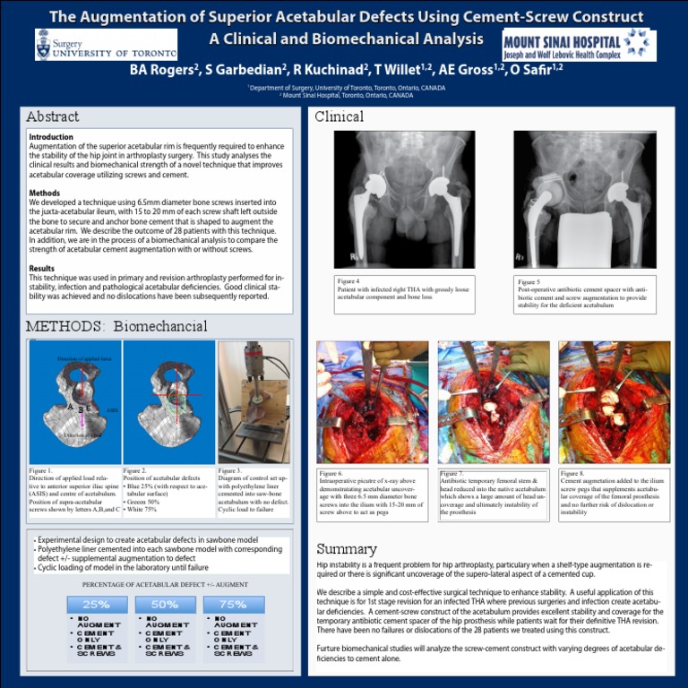 Acetabular Augmentation | PDF | Medical Specialties | Surgery