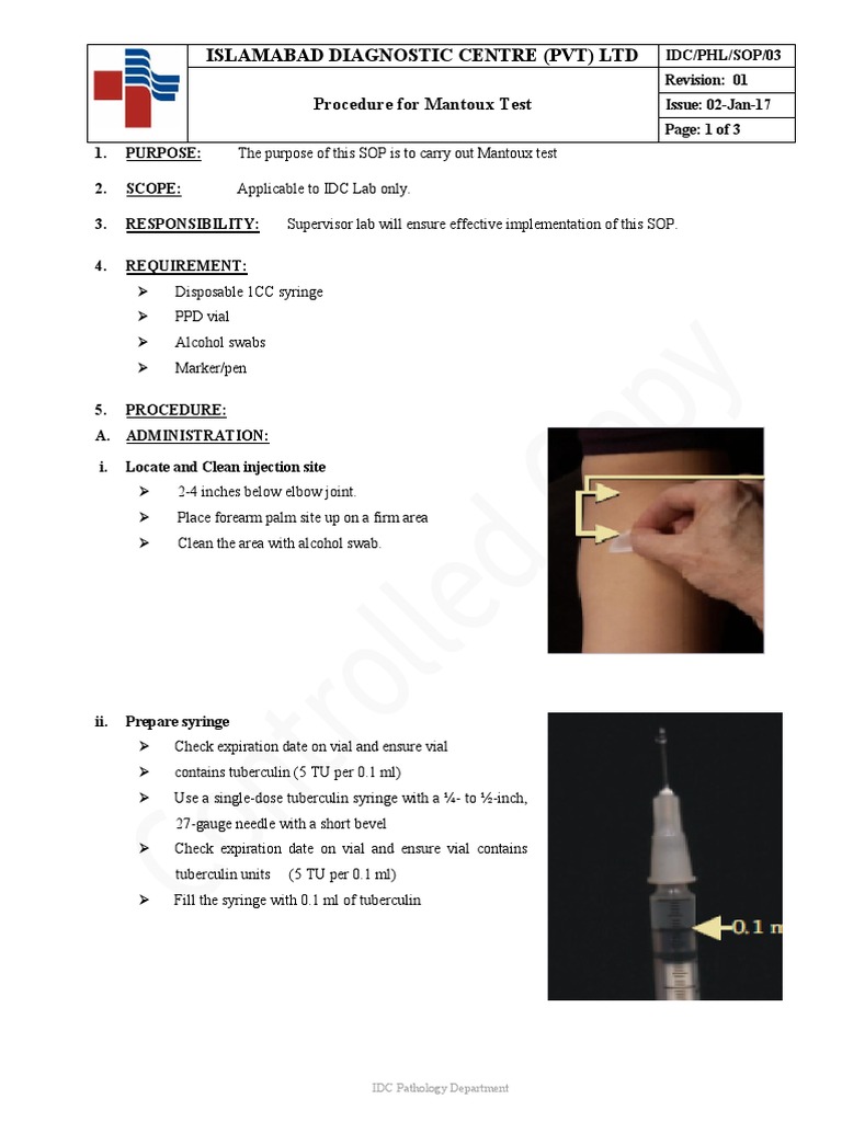 Procedure For Mantoux Test | PDF | Clinical Medicine | Medicine