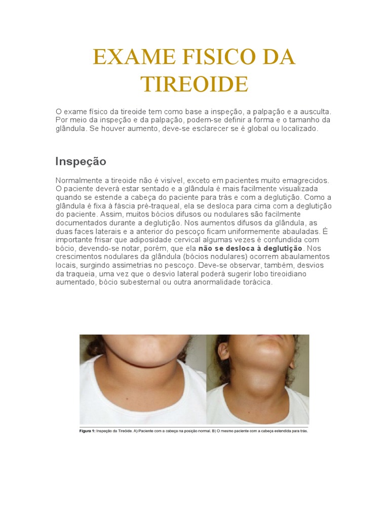 Exame Fisico Da Tireoide | PDF | Tireoide | Morfologia (Biologia)