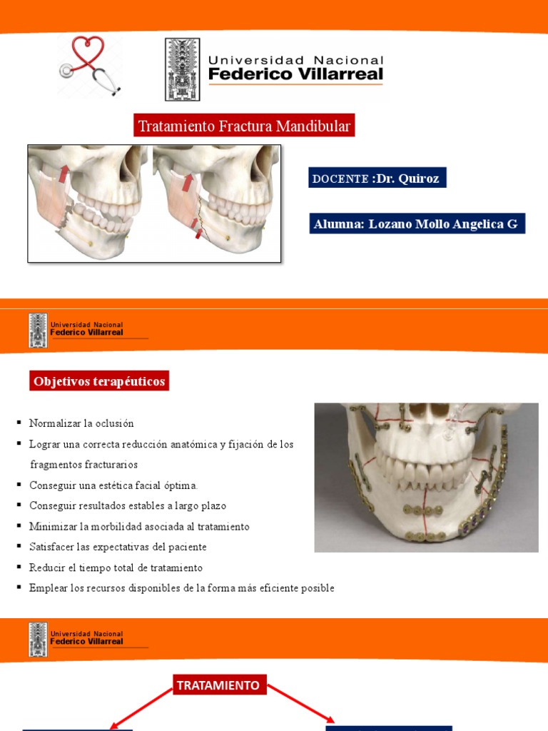 Tratamiento FM | PDF | Enfermedades y trastornos | Especialidades Medicas