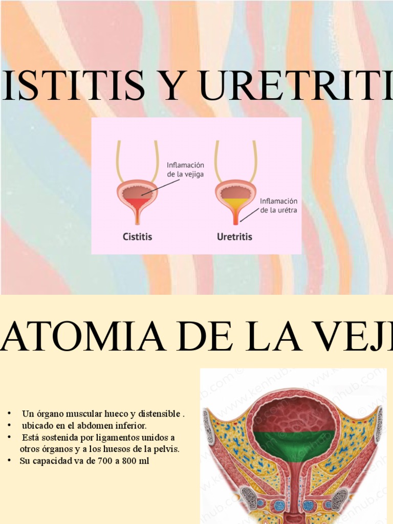 Expo Cistitis Uretritis | PDF | Vejiga urinaria | Sistema urinario