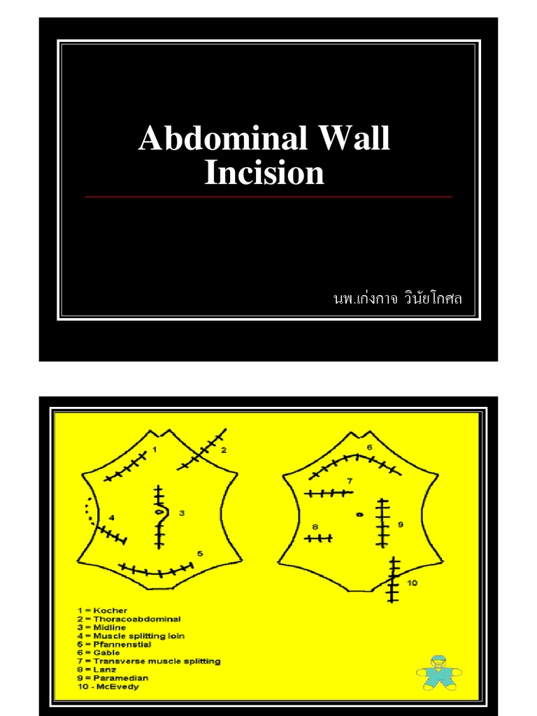 Types of Abdominal Incisions Explained | PDF | Abdomen | Human Anatomy