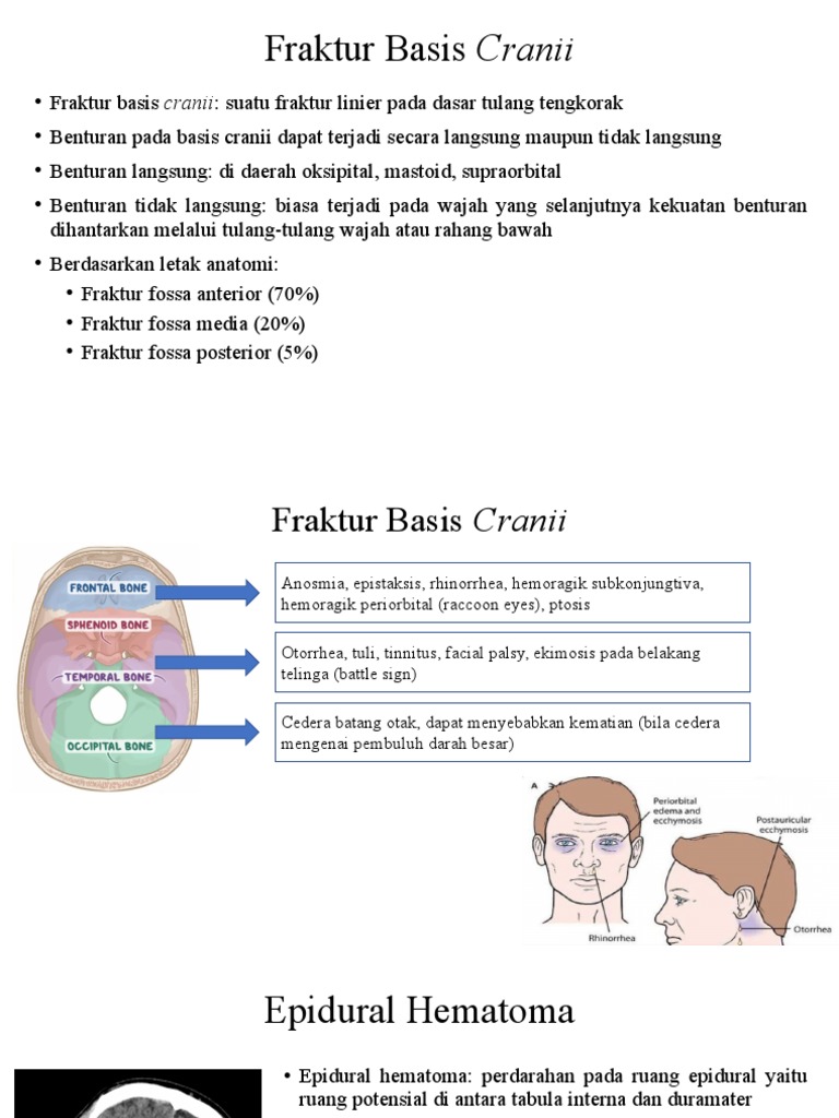 Fraktur Basis Cranii | PDF | Olahraga & Rekreasi