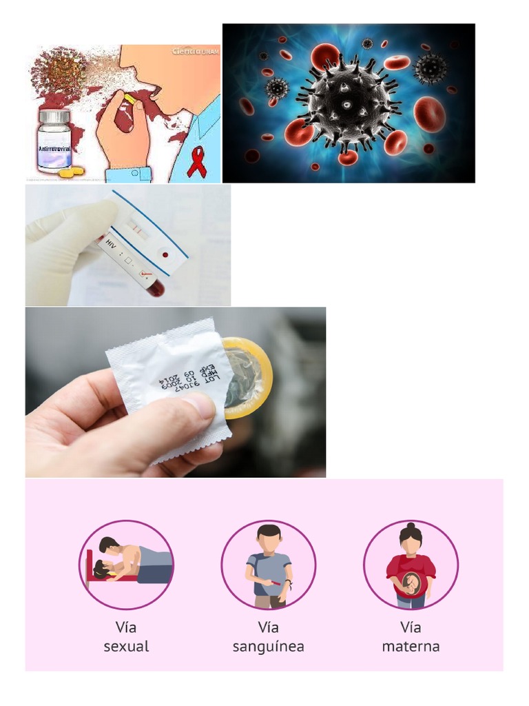 Vih y Sida Infografia | PDF