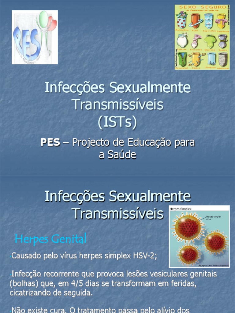 Apresentação Das IST | PDF | HIV/AIDS | Infecção sexualmente transmissível