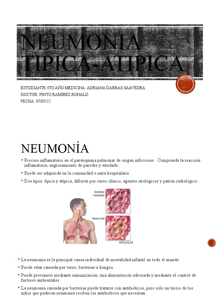 Neumonía: Tipos y Tratamiento | PDF | Neumonía | Causas de la muerte