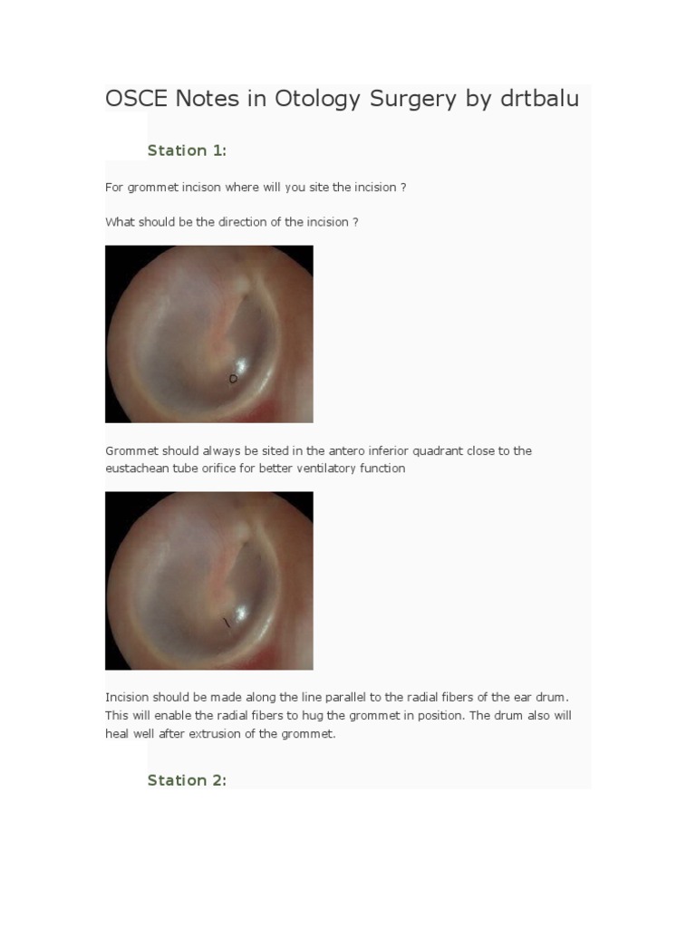 OSCE Notes in Otology Surgery by Drtbalu | PDF | Human Nose | Ear