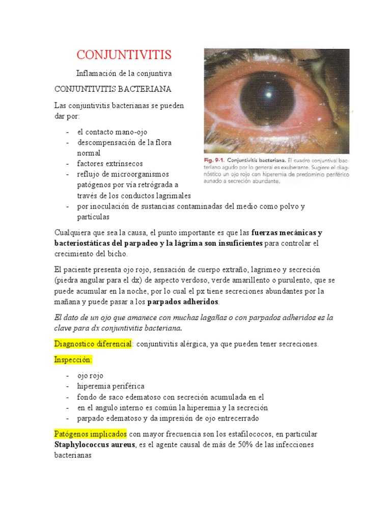 CONJUNTIVITIS | Descargar gratis PDF | Alergia | Enfermedades y trastornos