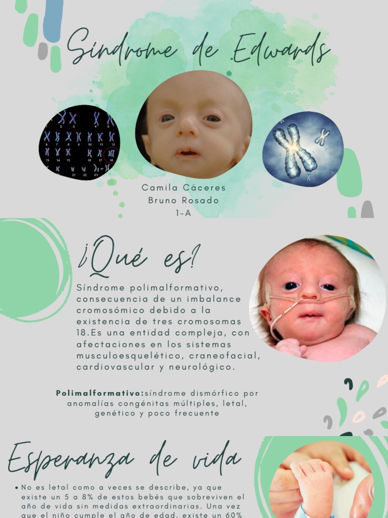 Síndrome de Edward | PDF | Especialidades Medicas | Enfermedades y ...