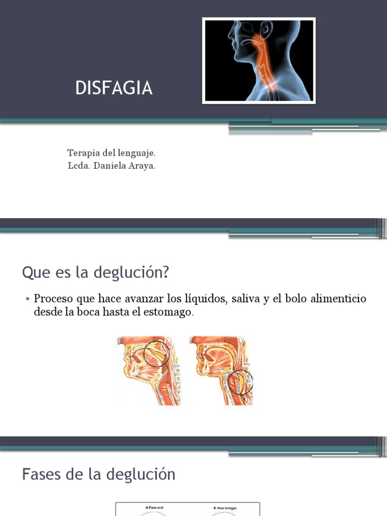 Disfagia | PDF | Esófago | Especialidades Medicas
