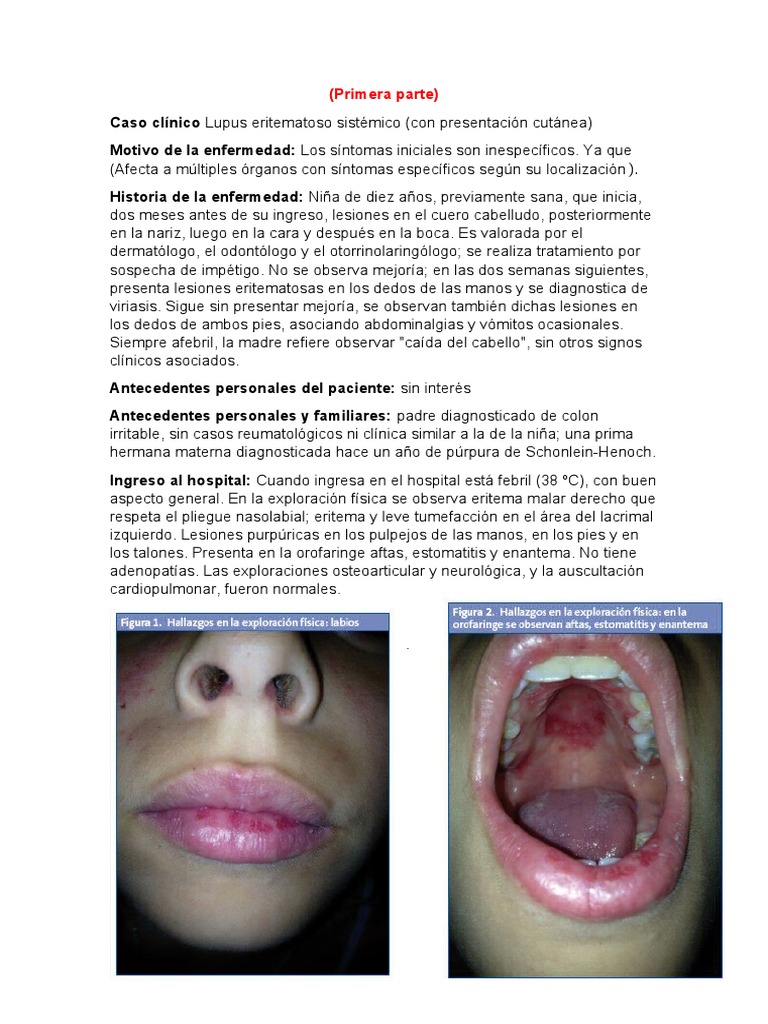 Caso Clinico | PDF | Medicina CLINICA | Enfermedades y trastornos