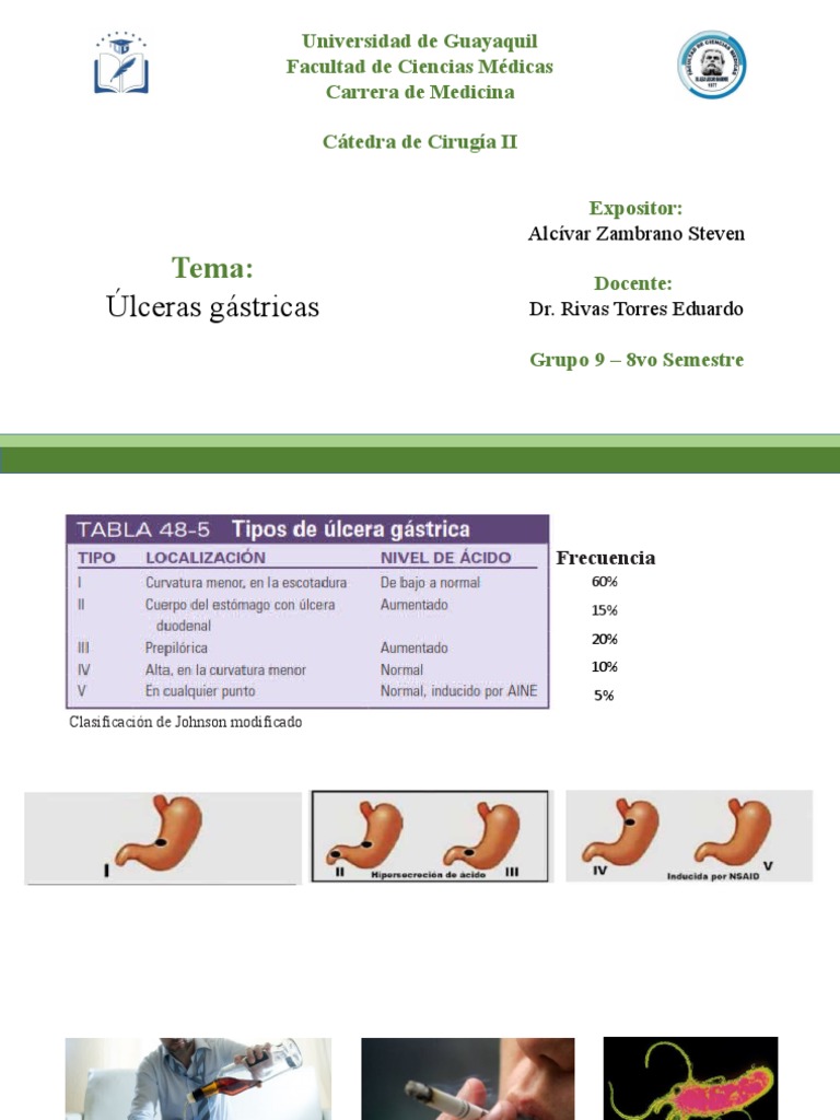 Ulceras Gastricas - ALCIVAR | PDF | Especialidades Medicas | Medicina