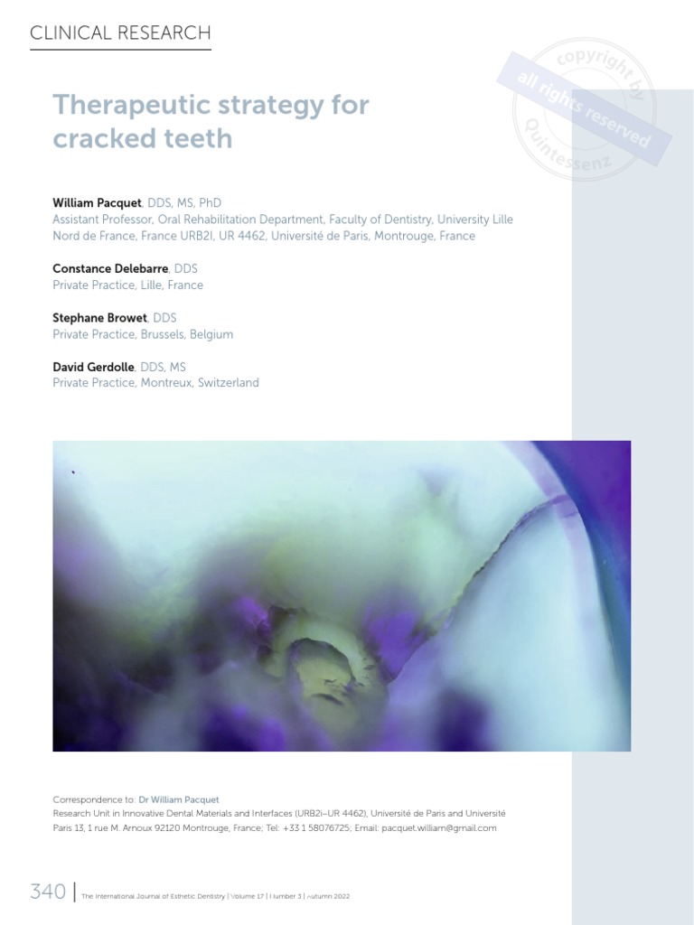 Ijed 2022 03 s0340CracksGerdolleBrowet | PDF | Tooth Enamel | Fracture