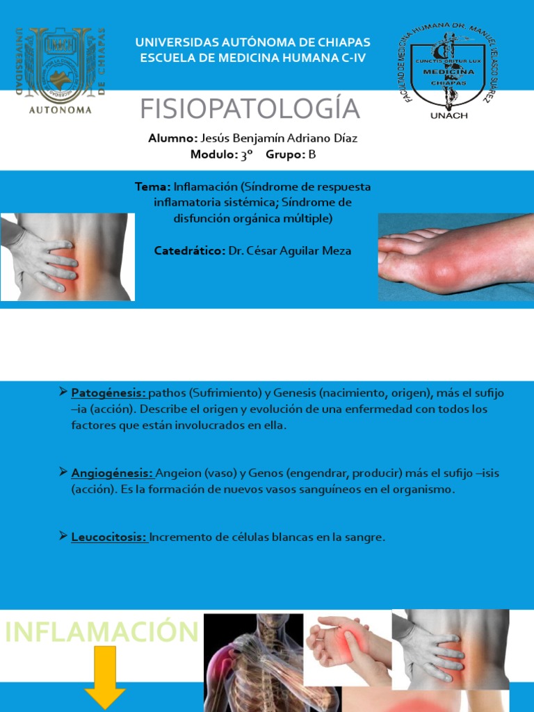Tumefacción y signos de inflamación | PDF | Inflamación | Anatomía