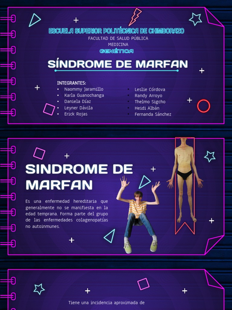 Síndrome de Marfán | PDF | Especialidades Medicas | Medicina CLINICA