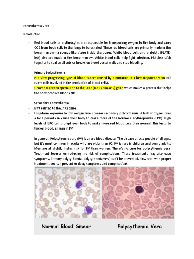 Polycythemia Vera | PDF | Blood Cell | Blood