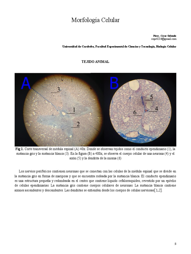 Morfología Celular | PDF | Cartílago | Hueso
