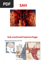 Bleed Vs Infarct Comparison | PDF | Nervous System | Neuroanatomy