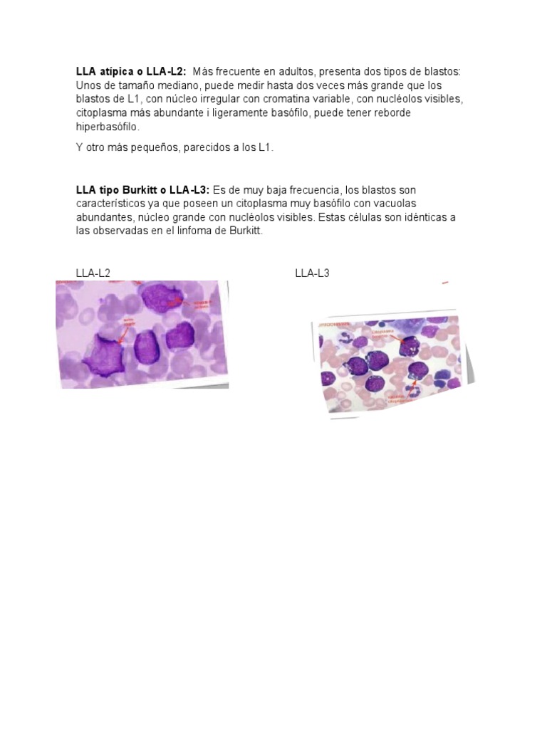 Lla-L2 Lla-L3 | PDF