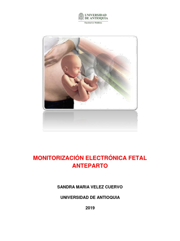 Monitorización Electrónica Fetal Anteparto. 2019 | PDF | El embarazo ...