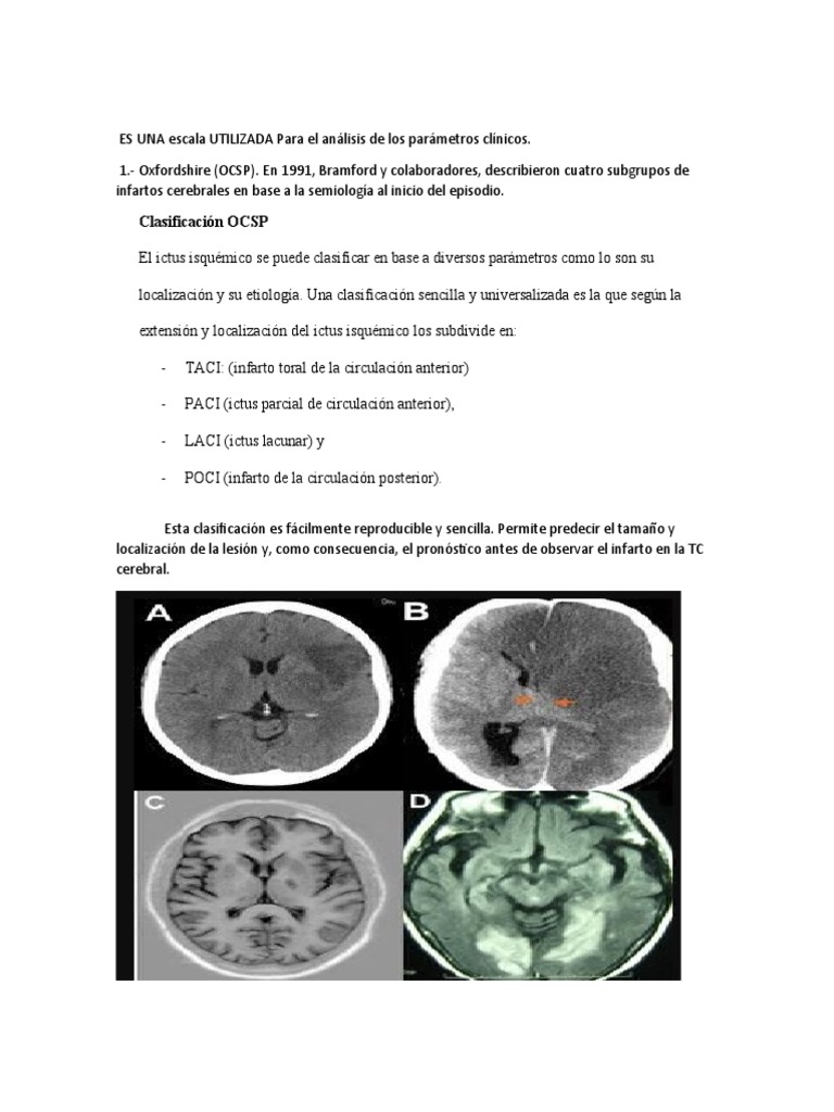 Clasificación de Ictus: OCSP y TOAST | PDF