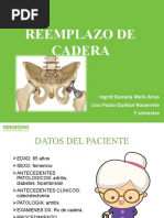 Cerclaje de Rótula: Técnica Quirúrgica | PDF | Articulación | Rodilla