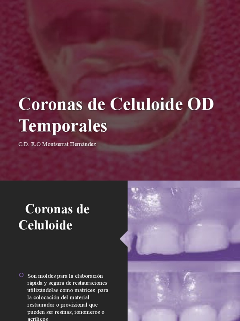 Coronas de Celuloide | PDF